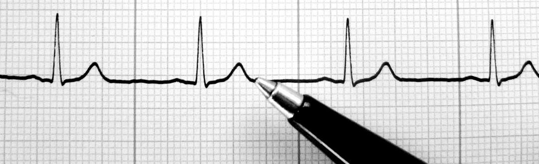 Heart Rate Survey Data | Tuva