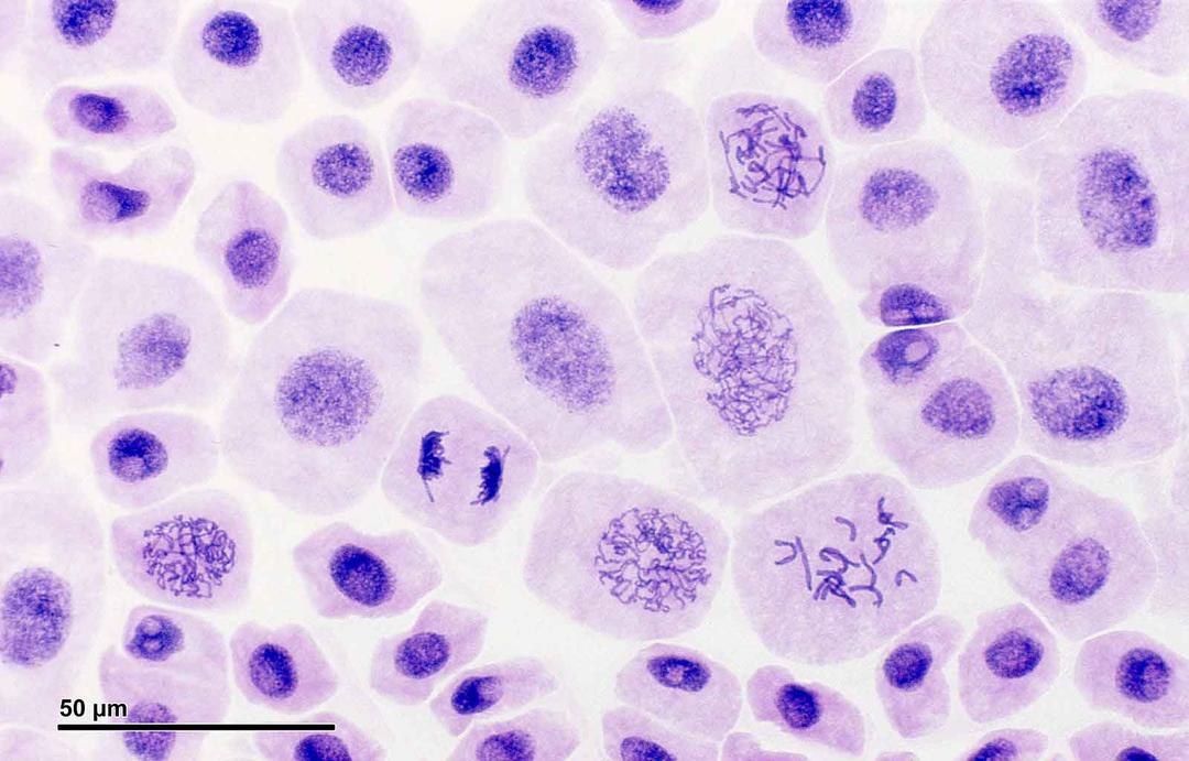 Mitosis Phases In Onion Root Tip Cells Tuva